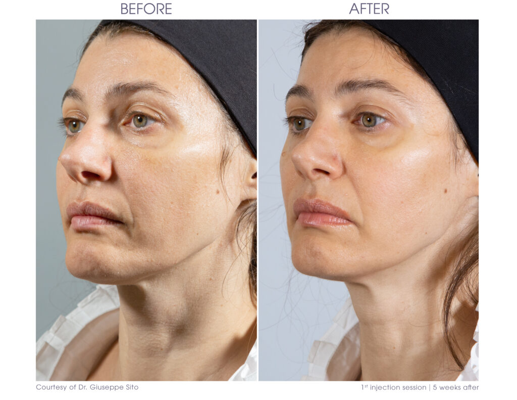 It’s still you – just boosted! - Face Oxford